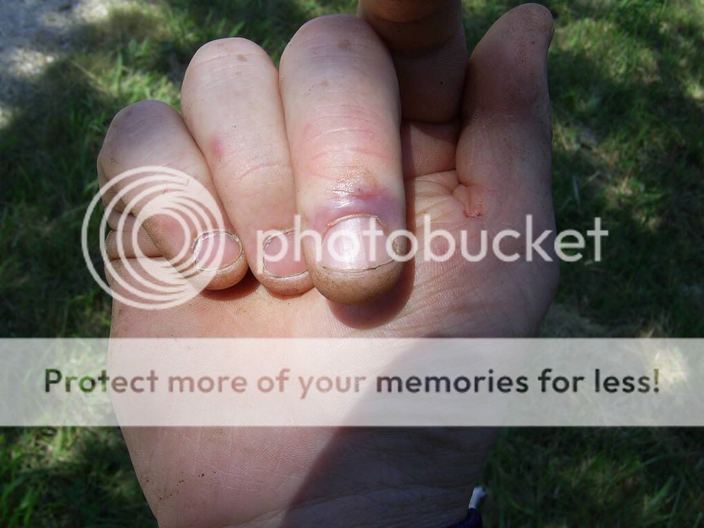 Most Painful Snake Bite - Comparing War Scars! | Reptile Forums