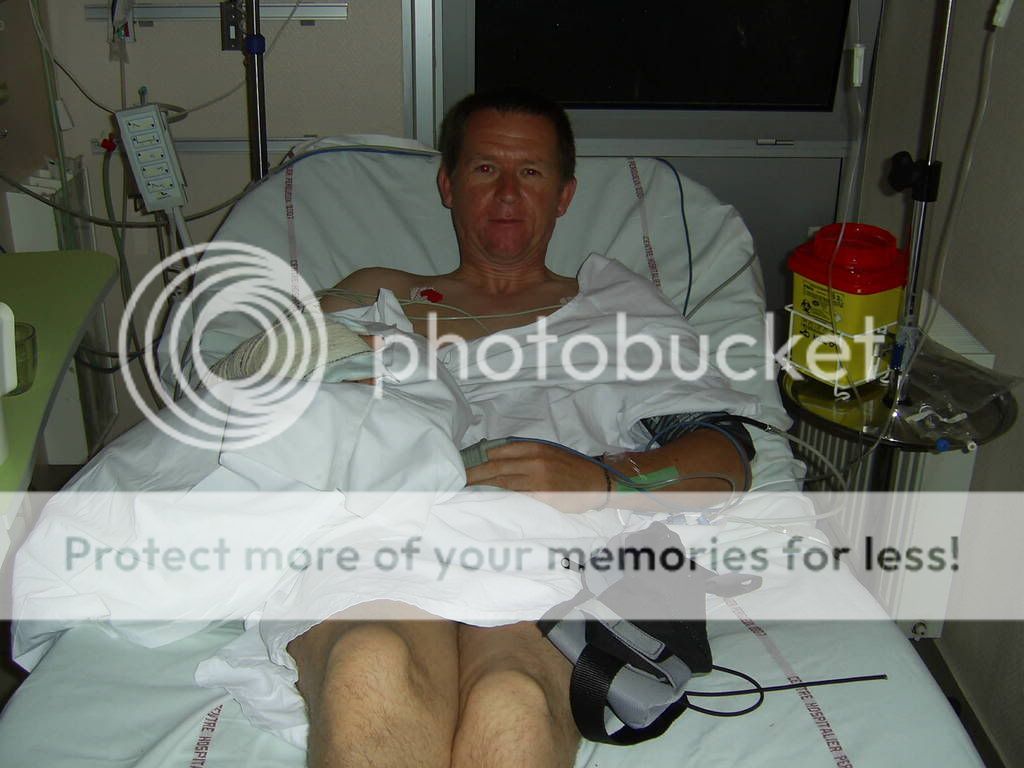 Most Painful Snake Bite - Comparing War Scars! | Reptile Forums